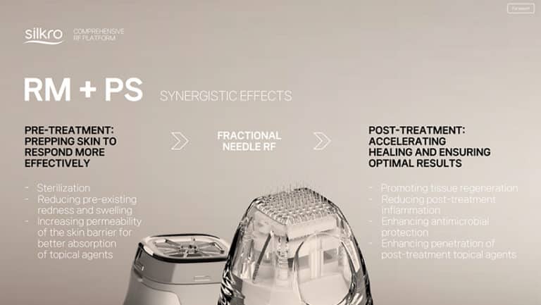 Silkro RF Microneedling Technology Overview | XOD